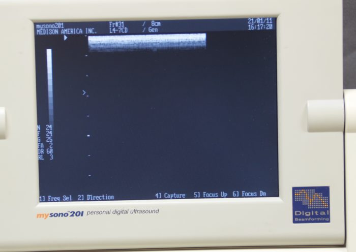 Medison MySono 201 Ultrasound (R16) - Apexx Solutions